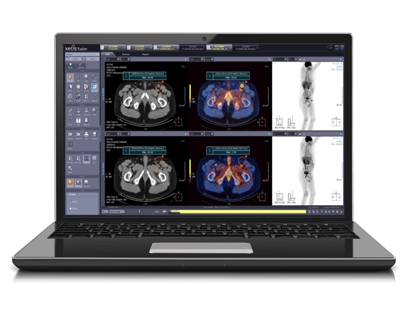 Picture Archiving and Communication System (PACS) | INFINITT North America