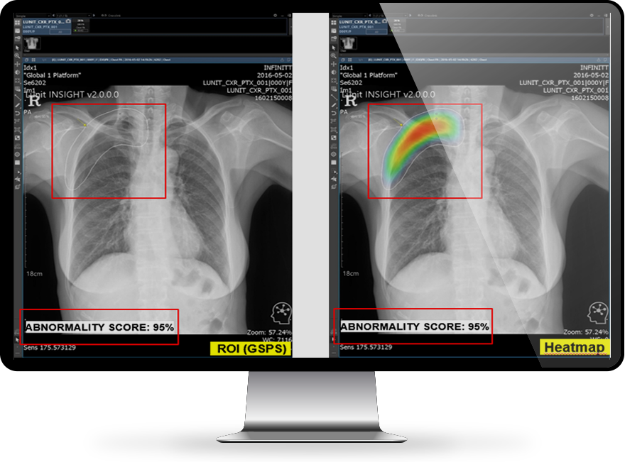 Other Imaging Solutions | INFINITT North America